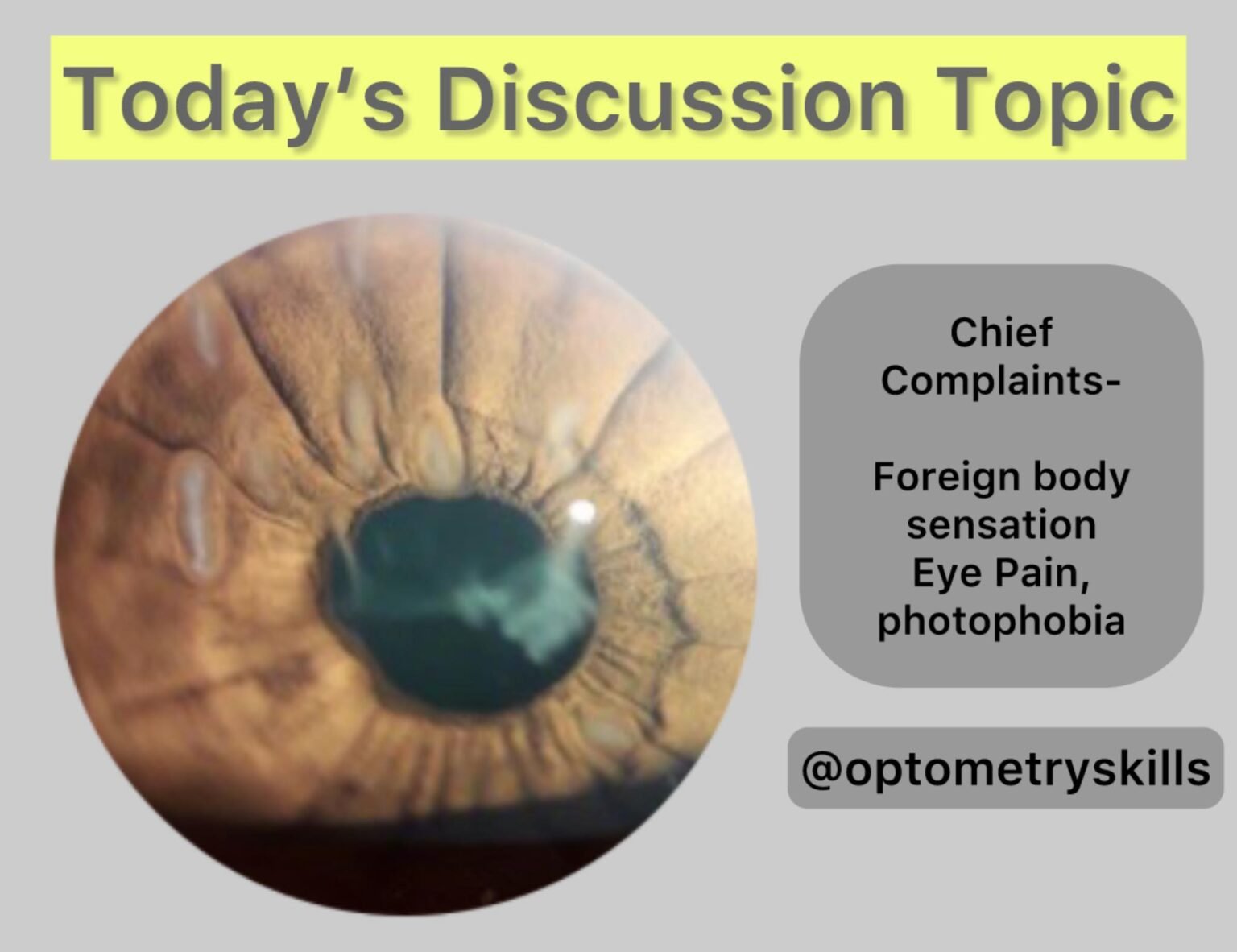 Filamentary Keratitis Notes - Optometryskills
