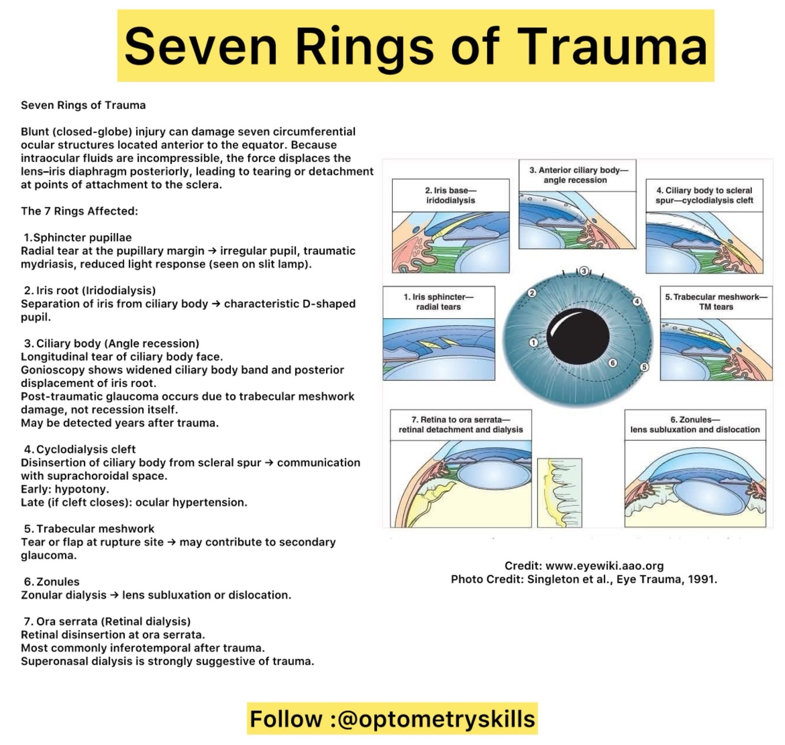Seven rings of Trauma - Optometryskills